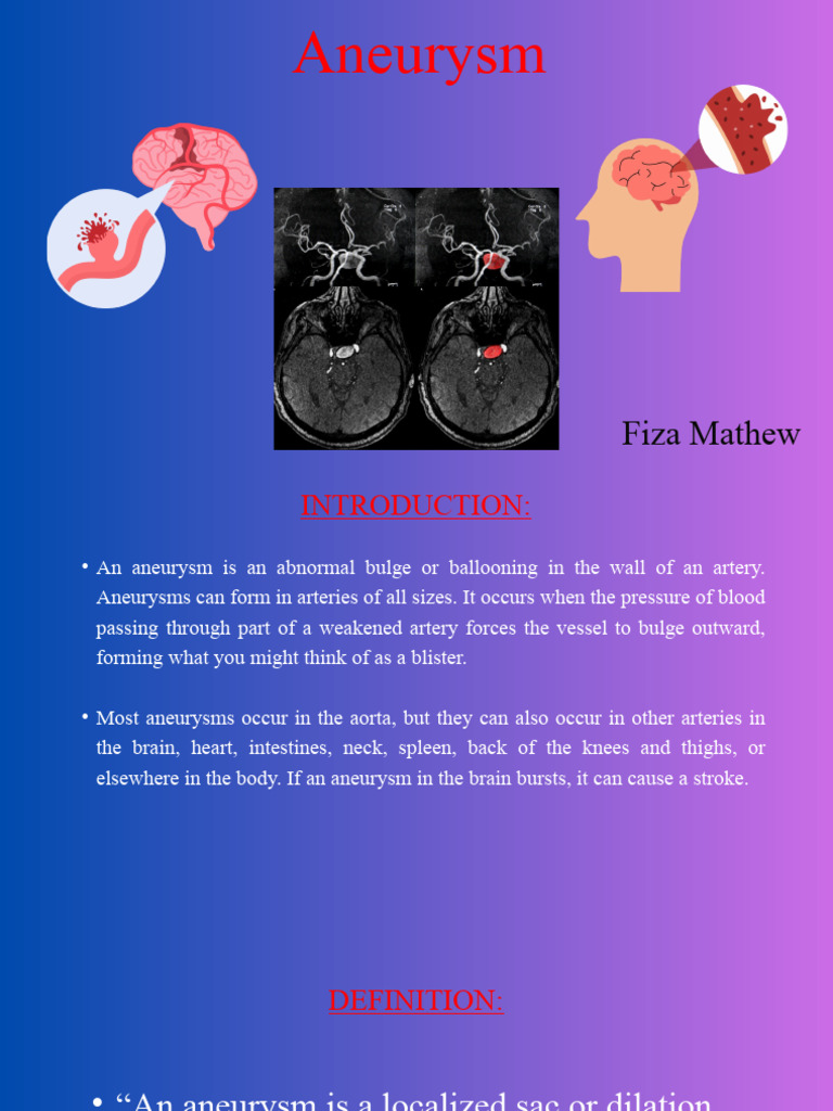 Understanding Aneurysms: Types and Risks | PDF | Aorta | Interventional Radiology