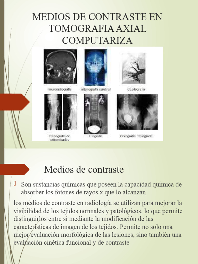 TEMA 2 MEDIOS DE CONTRASTE EN TOMOGRAFIA | PDF | Rayo X | Ct Scan