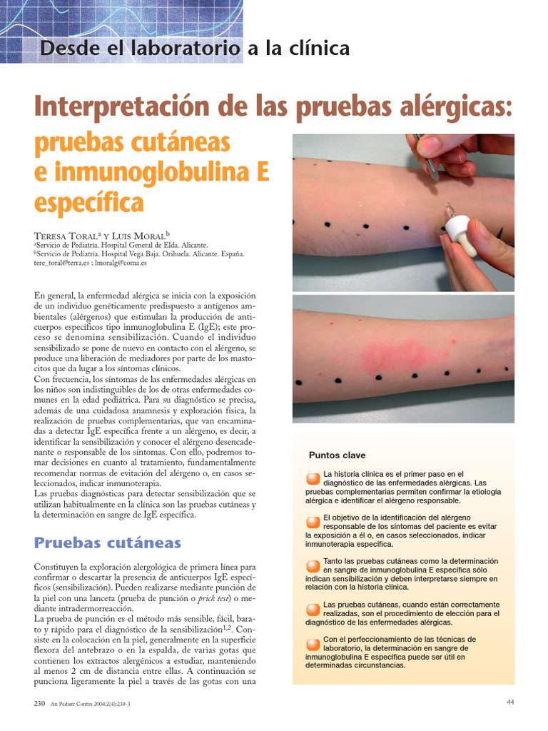 Interpretación de Las Pruebas Alérgicas:: Pruebas Cutáneas e Inmunoglobulina E Específica | PDF ...