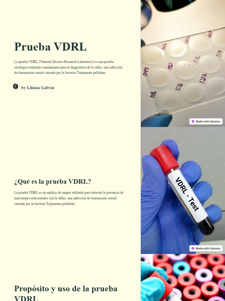 Prueba VDRL | PDF | Microbiología | Ciencias de la Salud