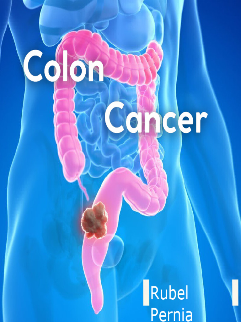 Cáncer de Colon | PDF | Colorectal Cancer | Cancer