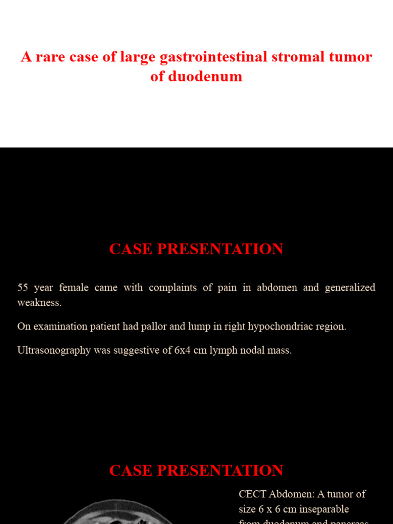 duodenAL GIST Case | Download Free PDF | Pancreas | Gastroenterology