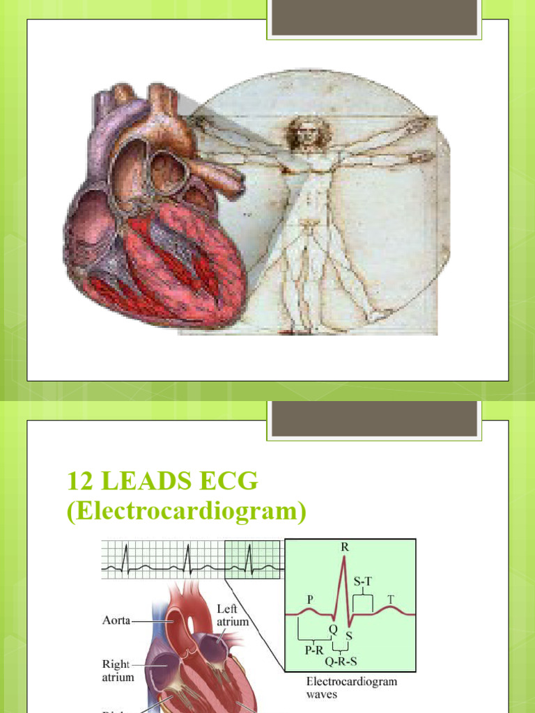 12 Leads Ecg | PDF