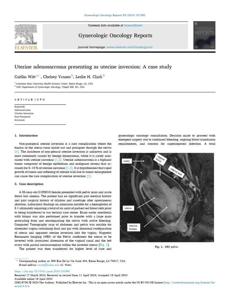 Uterine Adenosarcoma Presenting As Uterine Inversion A Case Study | PDF ...