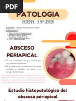 Infografia Abscesos Periapicales | PDF | Estudios de idiomas extranjeros