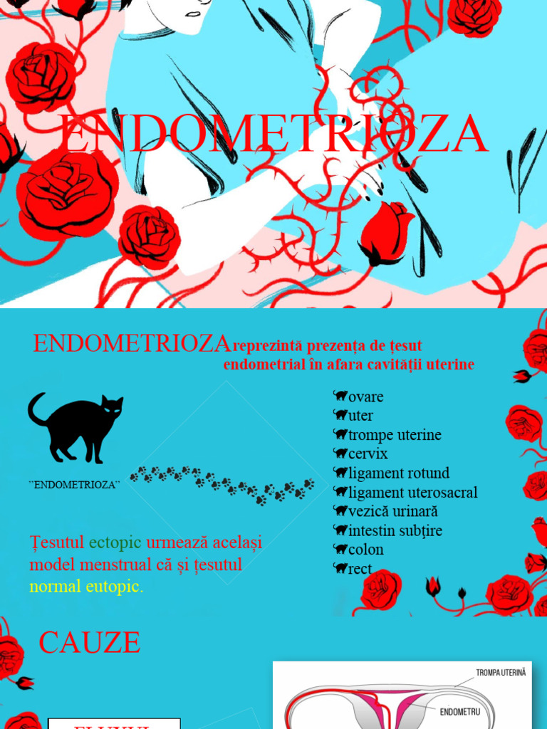 Endometrioza Si Sangerari | PDF