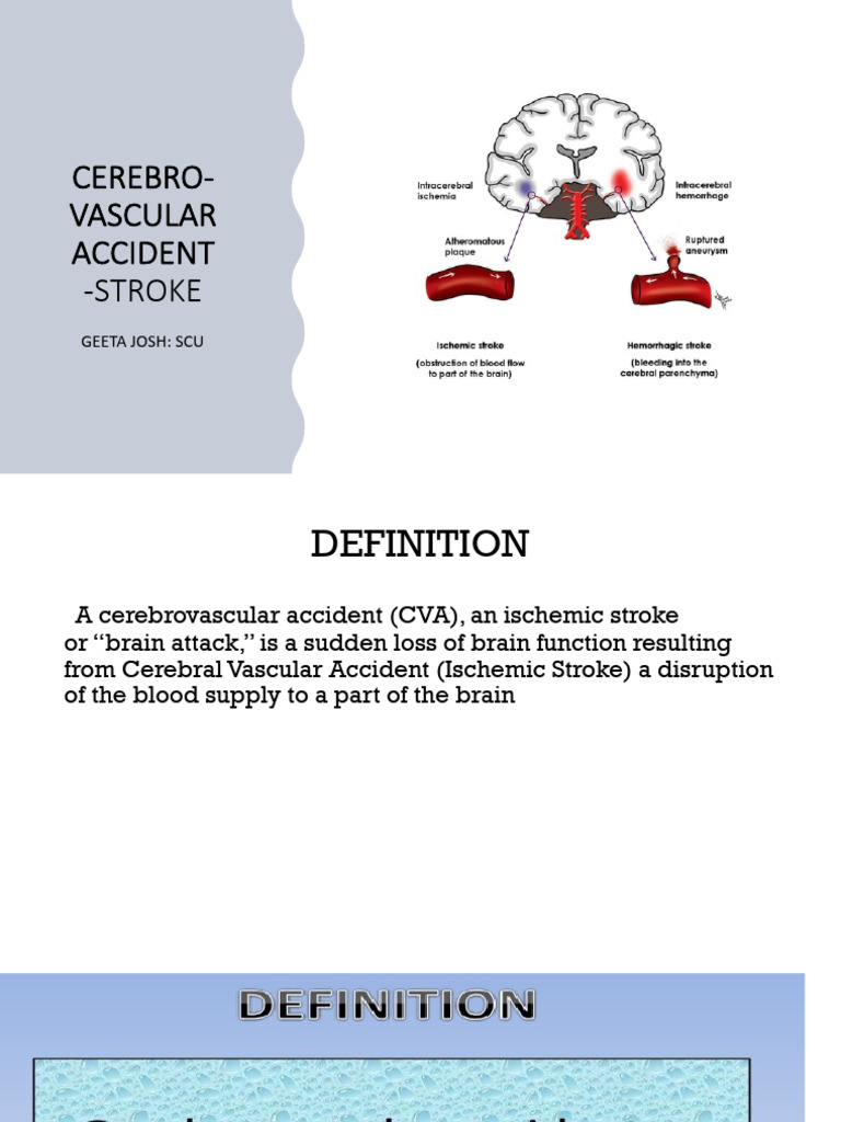 Management of A Cerebro-Vascular Accident (CVA) PT | PDF | Stroke ...