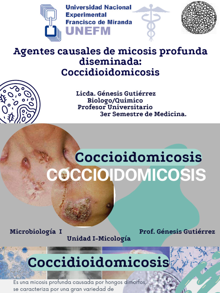 Coccidioidomicosis | Descargar gratis PDF | Causas de la muerte | Biología