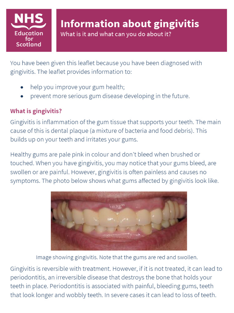 Information About Gingivitis | PDF | Toothbrush | Human Tooth