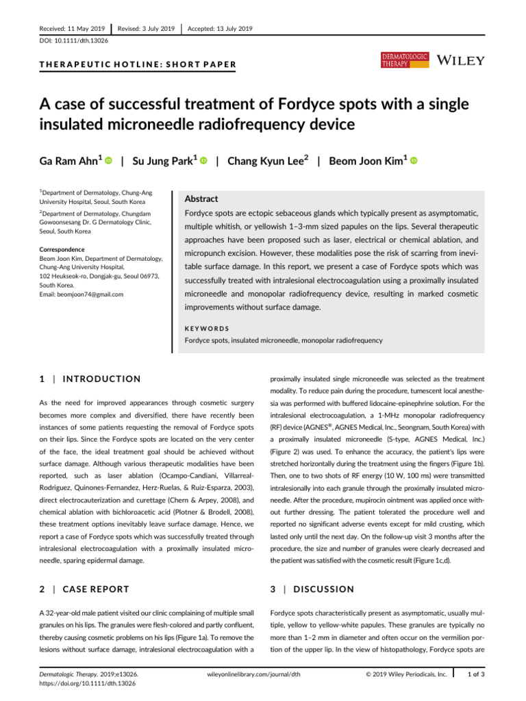 Fordyce Spots With A Single Insulated Microneedle Radiofrequency Device ...