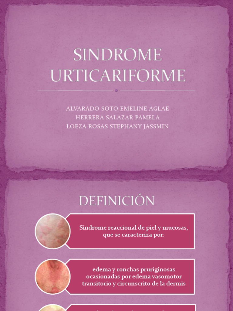 SINDROME Urticariforme | PDF | Alergia | Medicina CLINICA