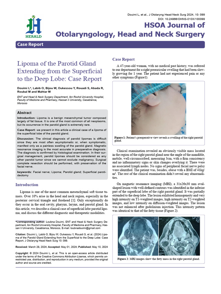 Lipoma of the Parotid Gland Extending From the Superficial to the Deep ...