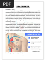 Pacemaker Block Diagram Explanation | PDF