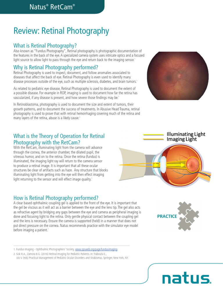 031569A - ROP - Review Retinal Photography | PDF | Retina | Optics