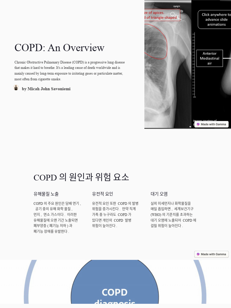 Copd An Overview Pdf