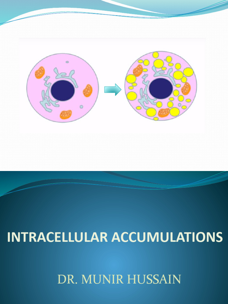 Intracellular Accumulations | PDF | Cholesterol | Atherosclerosis