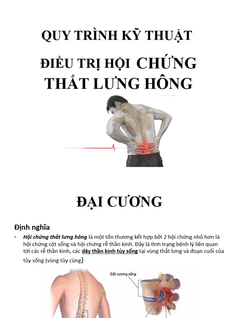 QTKT XBBH Hội Chứng Thắt Lưng Hông | PDF