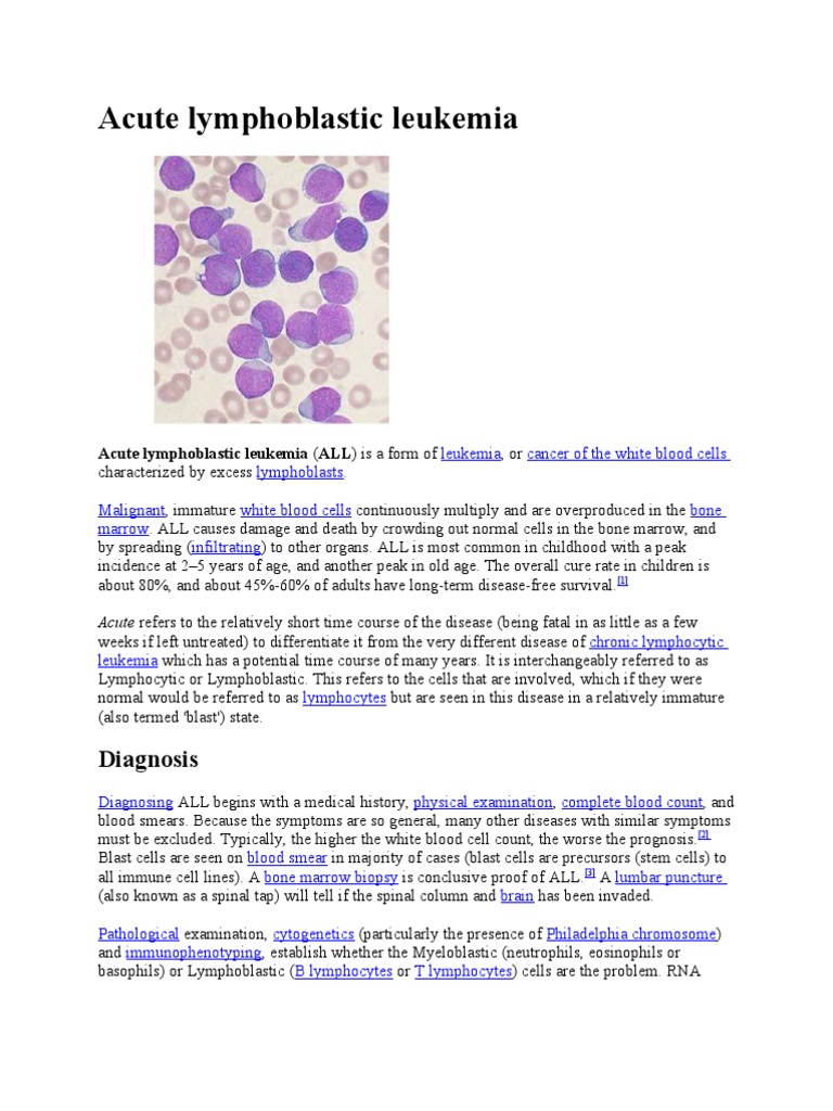 Acute Lymphoblastic Leukemia | PDF | Leukemia | Chemotherapy