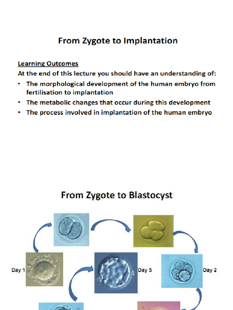 Embryo Development II Zygote To Implantation DICKSON MAWUSI 1 | PDF