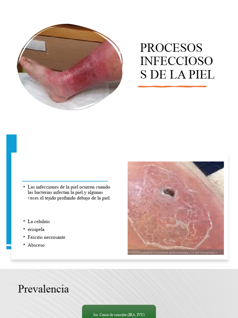 Procesos Infecciosos de La Piel | Descargar gratis PDF | Causas de la ...
