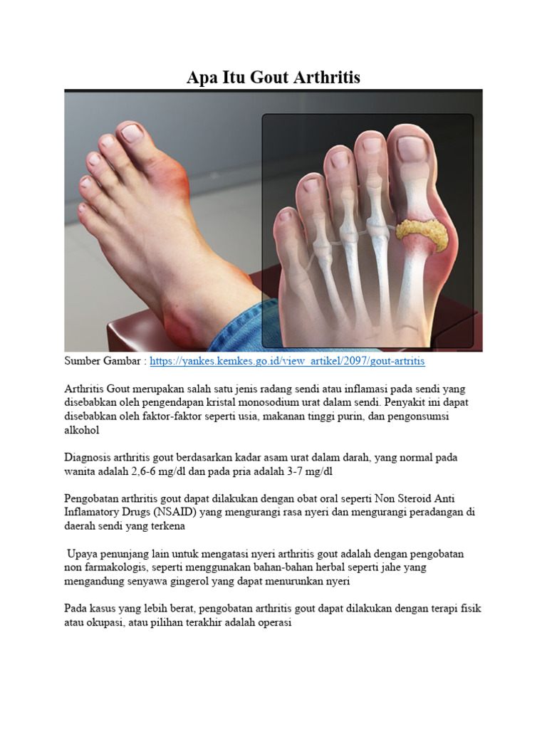 Apa Itu Gout Arthritis | PDF