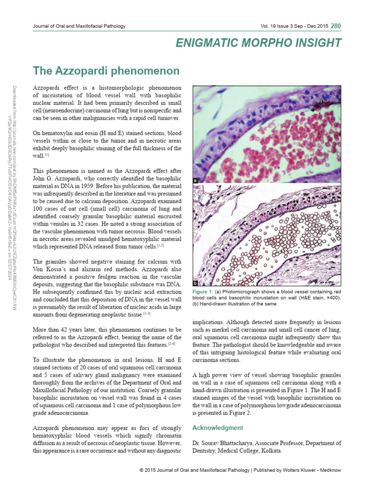 The Azzopardi Phenomenon.4 | PDF | Carcinoma | Pathology