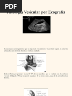 Vesícula en Porcelana y Signo de WES | PDF | Ciencia y matemáticas