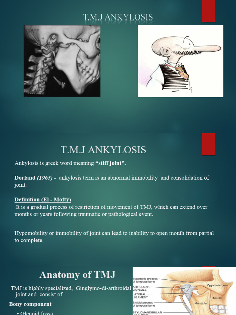 RNT TMJ | PDF | Diseases And Disorders | Medical Specialties