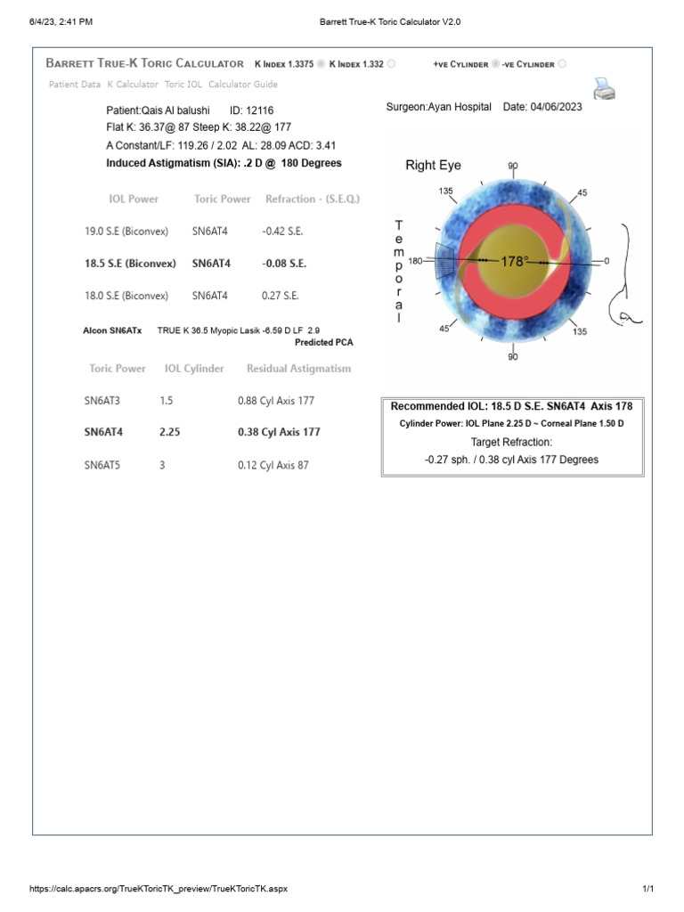 Barrett True-K Toric Calculator Results | PDF