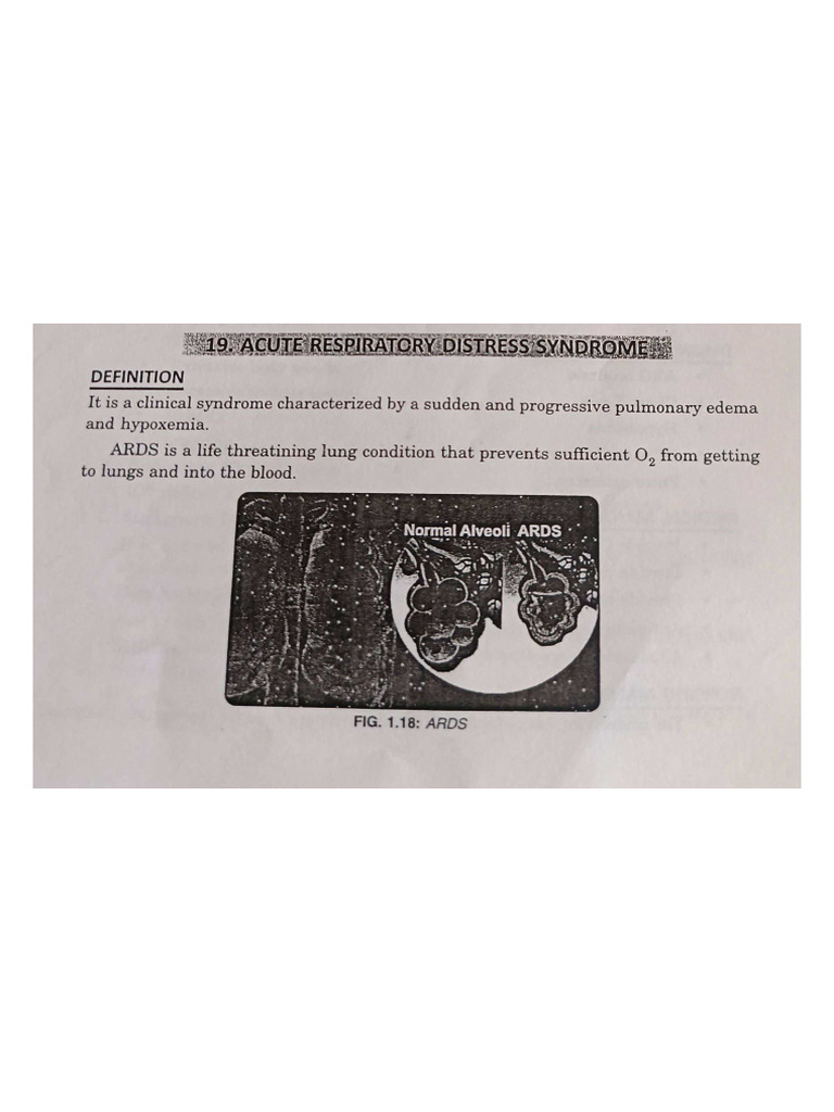Ards | PDF