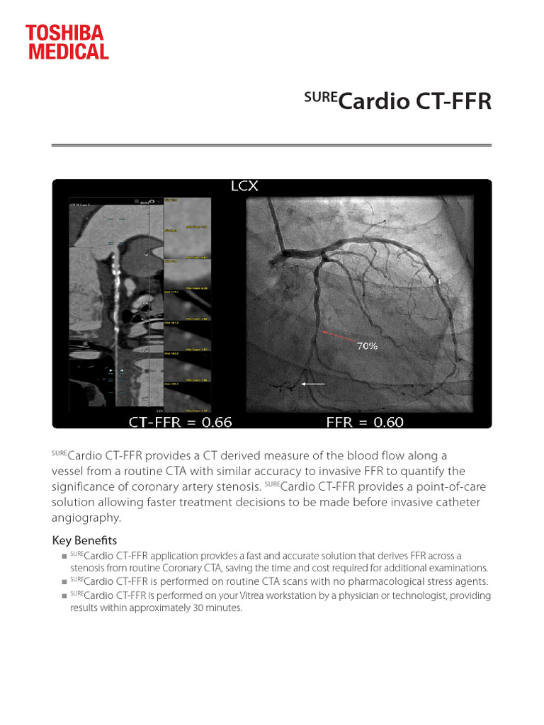 SURECardio CT-FFR | PDF | Cardiovascular System | Medical Specialties