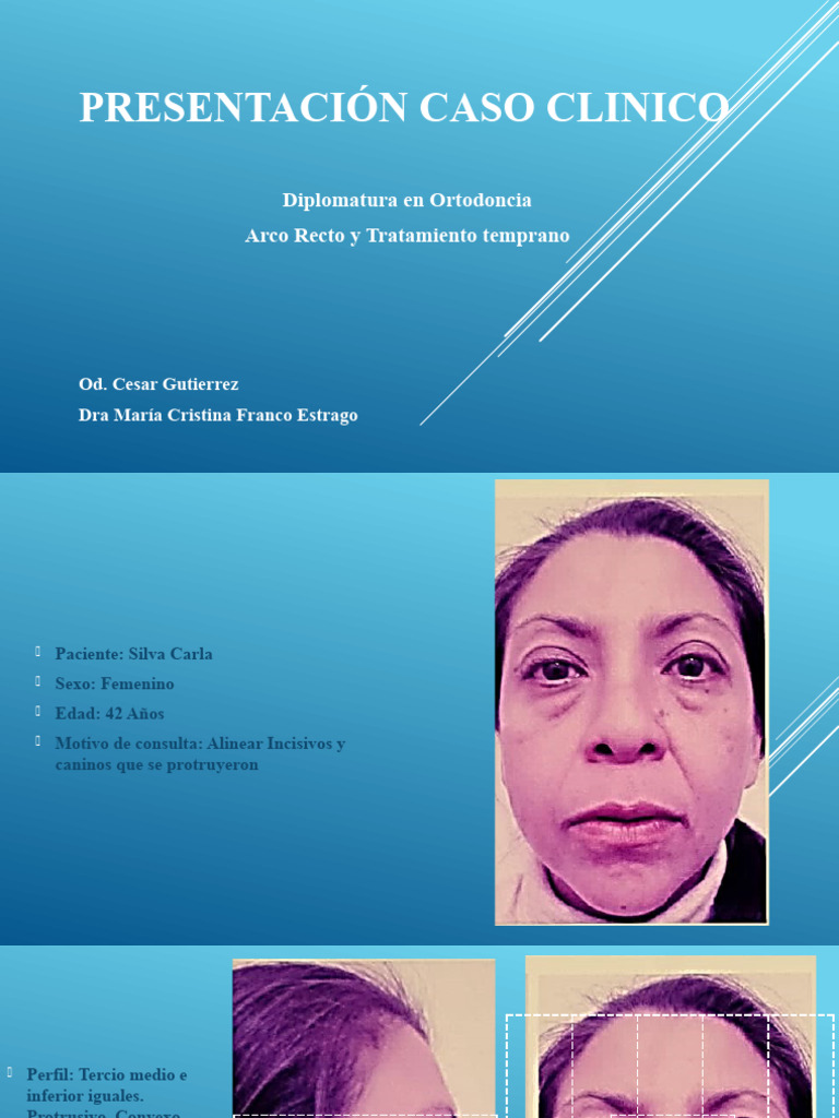 Presentación Caso ClInIco | PDF | Ciencia y matemáticas