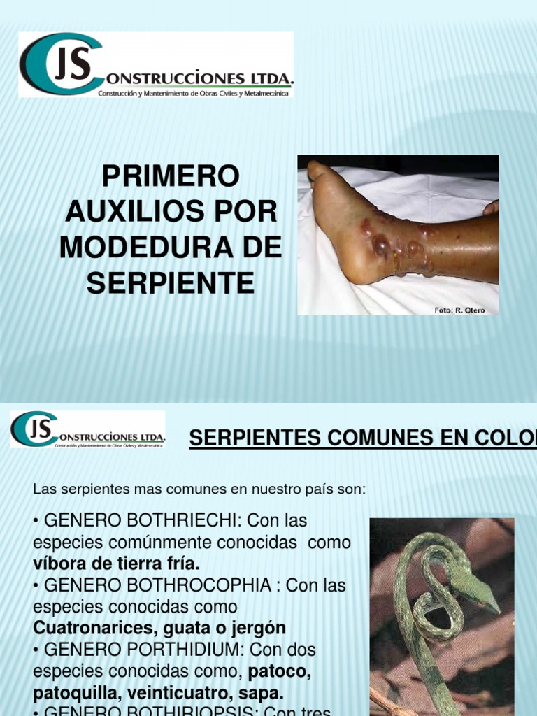 Cómo Tratar Las Mordeduras De Serpiente 6 Pasos Esenciales Qizr