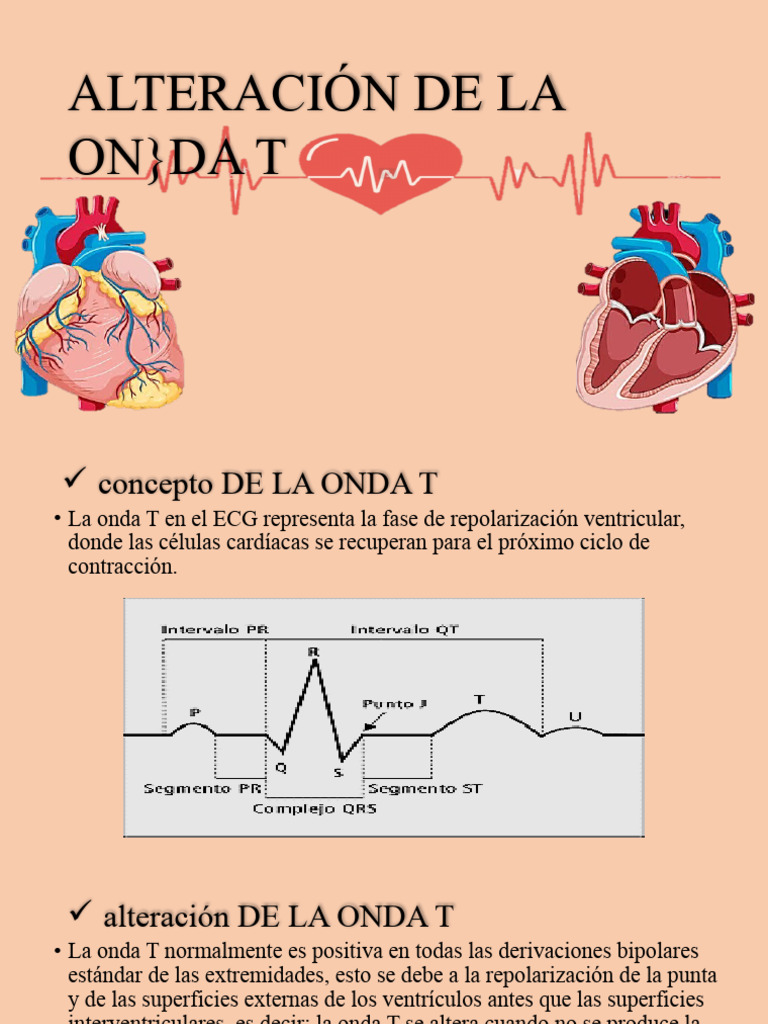 Diapositiva Onda T | Descargar gratis PDF | Electrocardiografia | Corazón