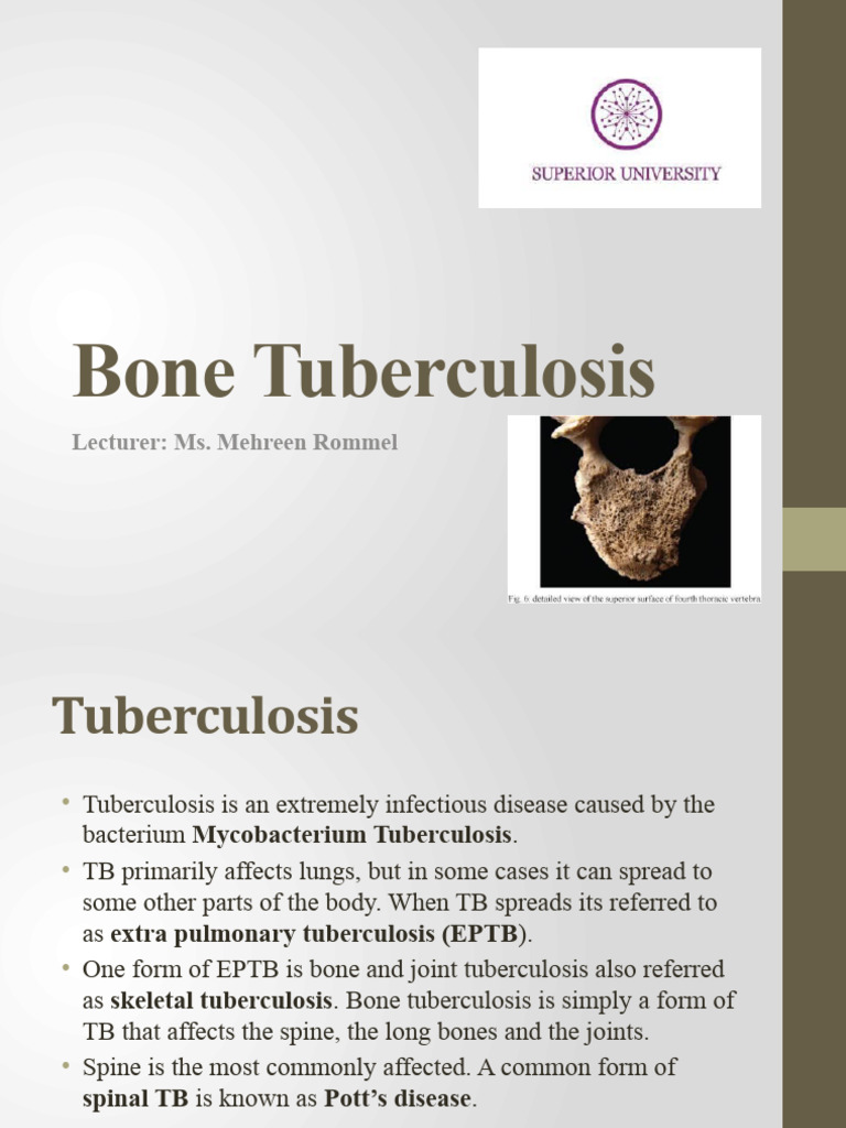 Bone Tuberculosis | PDF | Tuberculosis | Medicine