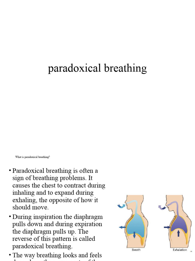 Understanding Paradoxical Breathing | PDF | Breathing | Apnea