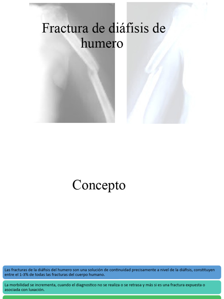 Fracturas de diáfisis de Húmero | PDF | Anatomía | Sistema ...
