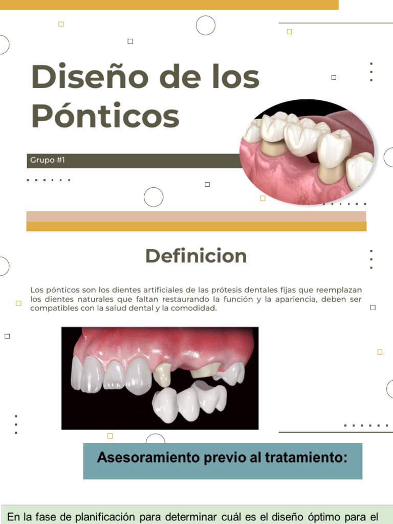 Pónticos | PDF | Odontología | Boca
