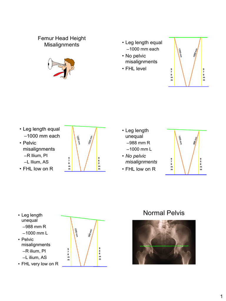 Normal Pelvis | PDF | Pelvis
