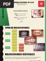 Presentación Edward Angle | PDF | Odontología | Ortodoncia