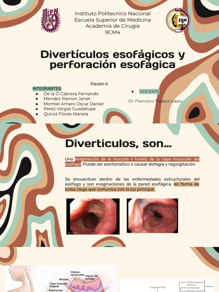 Divertículos Esofagicos y Perforacion Esofágica | PDF | Esófago ...