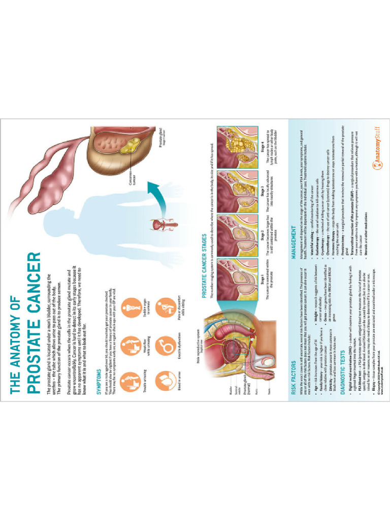 the-anatomy-of-prostate-cancer | PDF