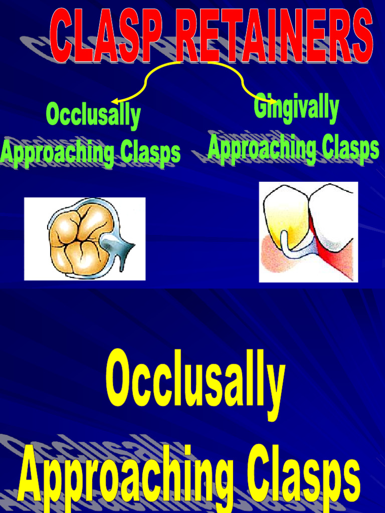 777 - Retention of RPD II-abo | PDF | Mouth | Tooth