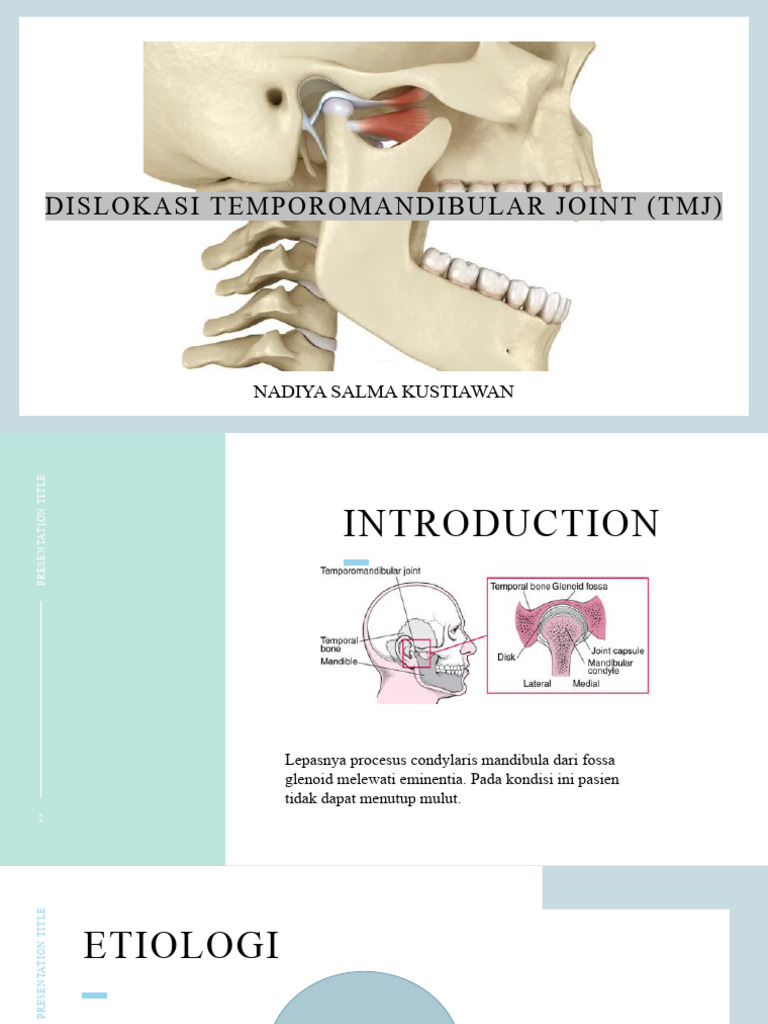 Dislokasi Temporomandibular Joint (TMJ) | PDF | Economies | Business Economics