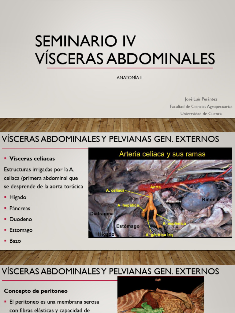 Clase Teórica - Visceras Abdominales | PDF | Abdomen | Estómago
