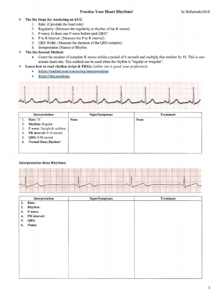 Practice Cardiac Rhythms | PDF