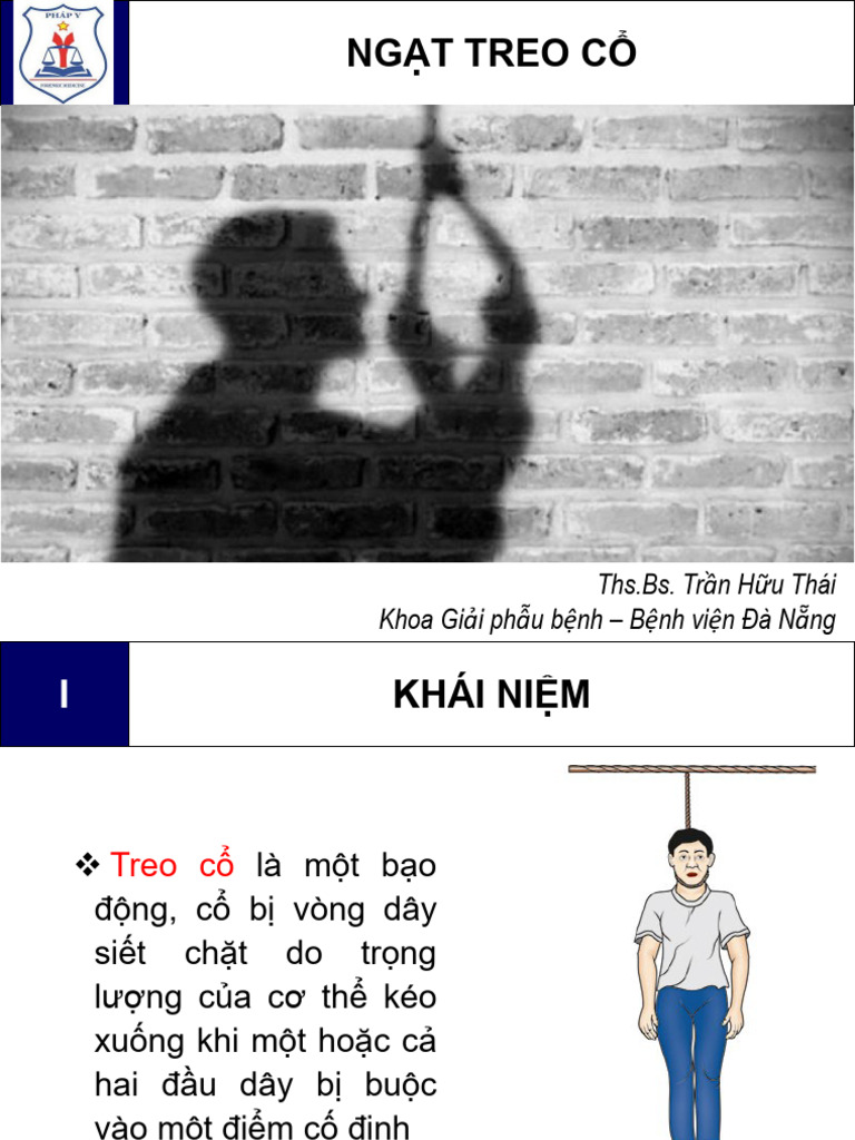 NG T Treo C | PDF