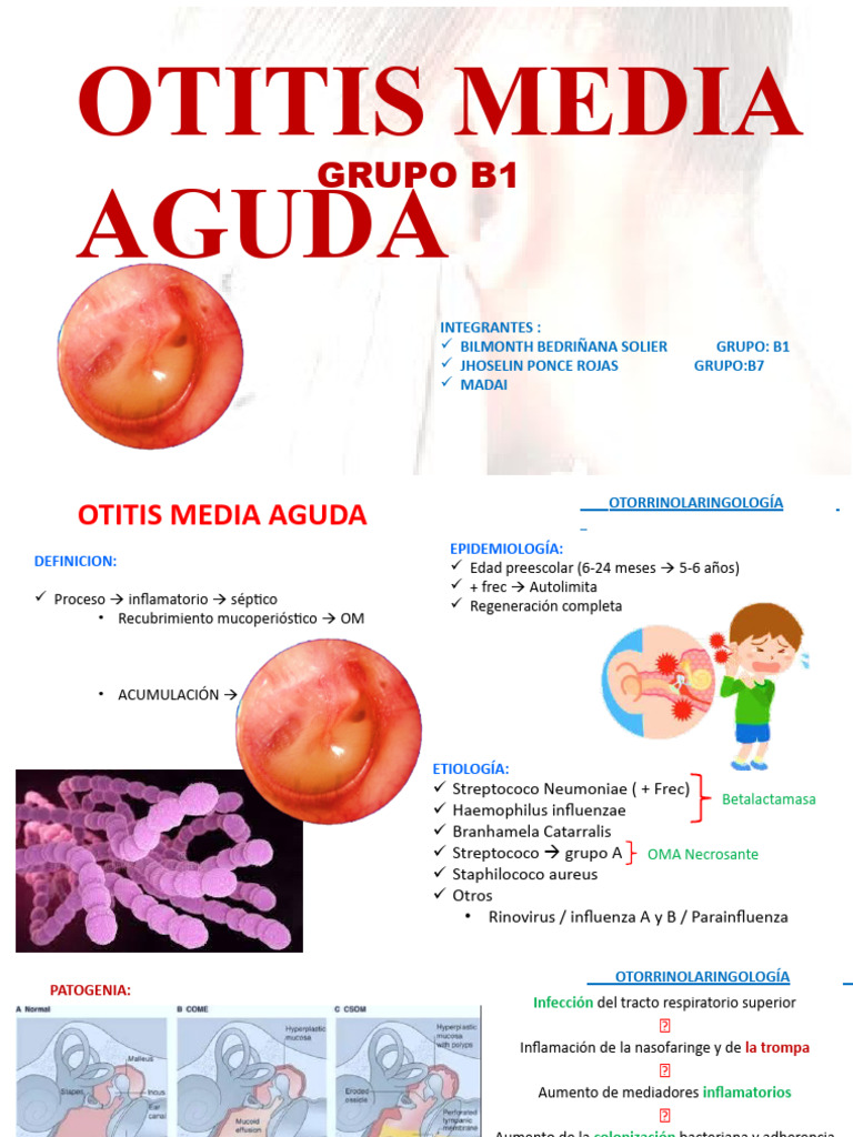Otitis Media Aguda | PDF | Especialidades Medicas | Enfermedades y trastornos