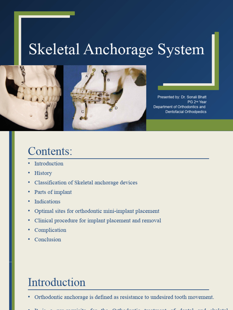 Skeletal Anchorage System | PDF | Dental Implant | Orthodontics