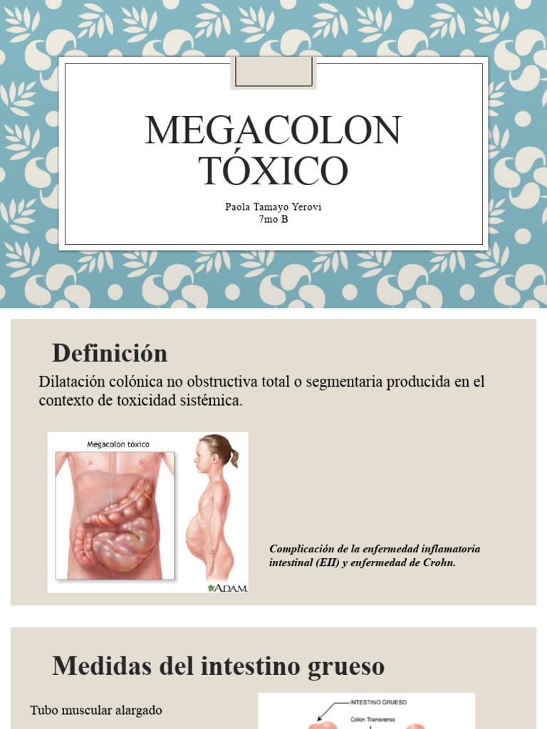 Presentación Gastro Megacolon | PDF | Diarrea | Enfermedad de Crohn